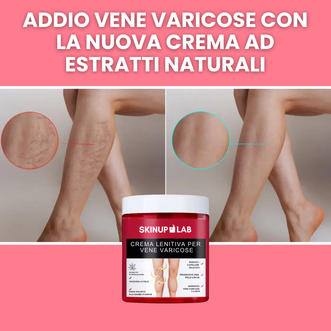 Crema gambe per eliminare definitivamente le vene varicose (80g ...